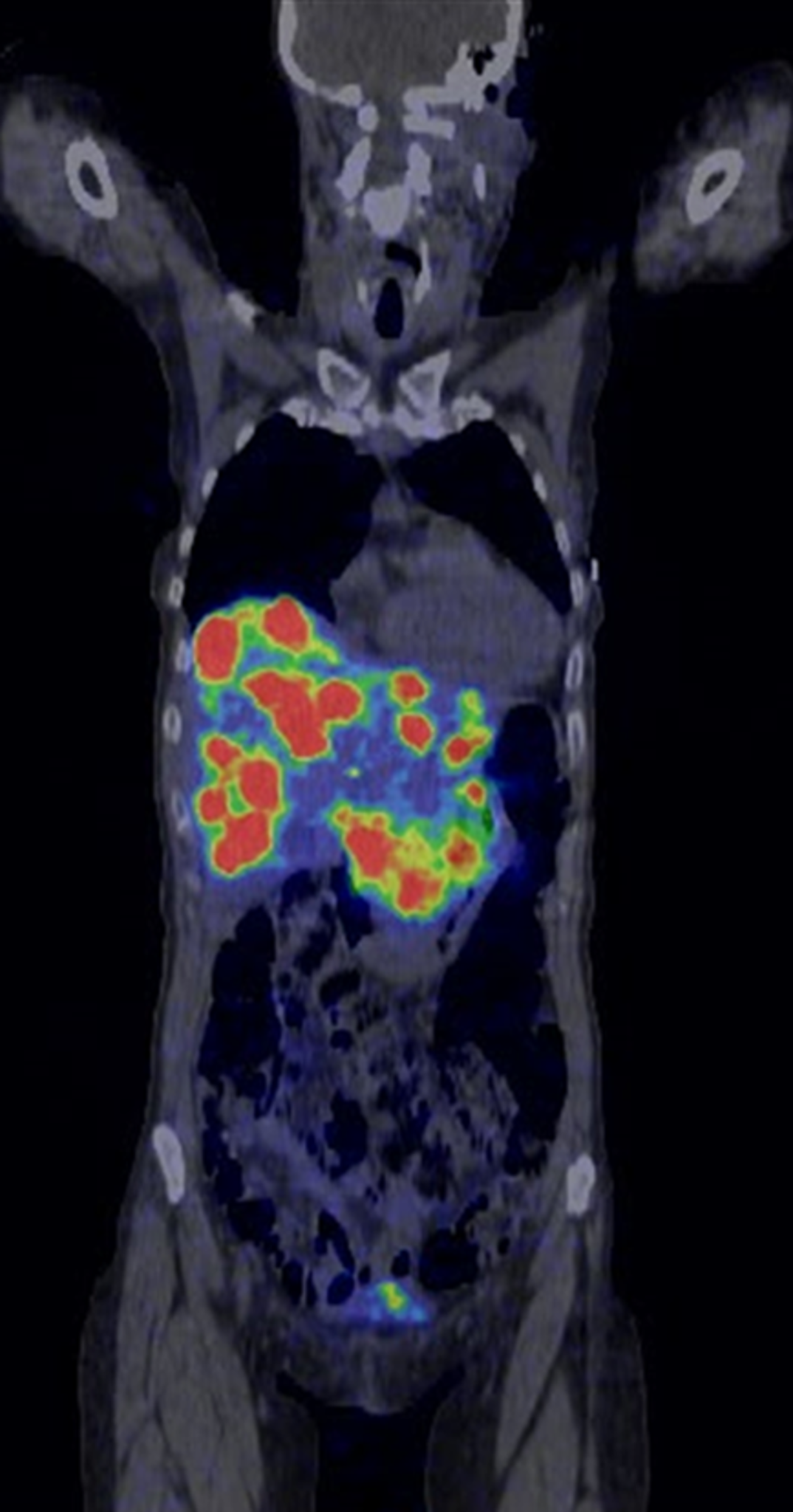 放射性医薬品前駆体 - Almac